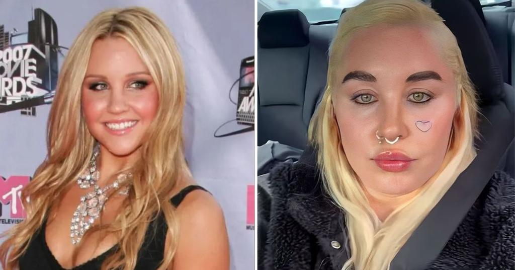 Amanda Bynes Unveils Stunning New Look After Getting Lip Fillers