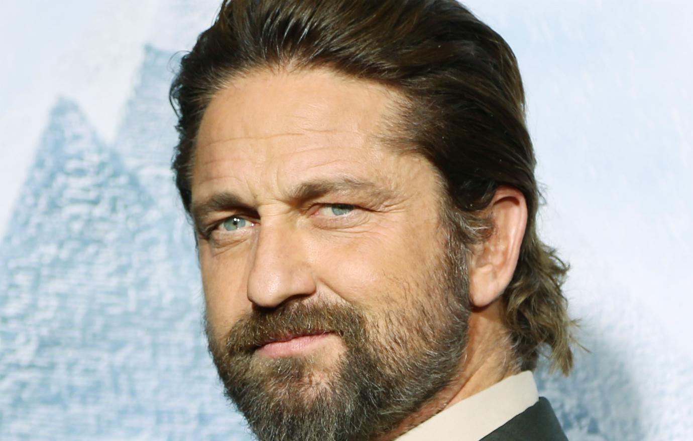 Famous Flaws! The Top 35 Celebrity Deformities