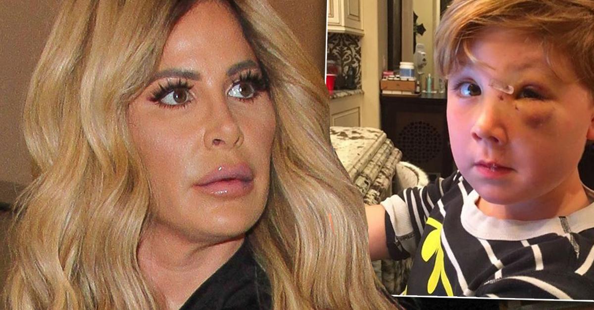[PIC] Kim Zolciak’s Son Kash Biermann Recovering After Dog Bite