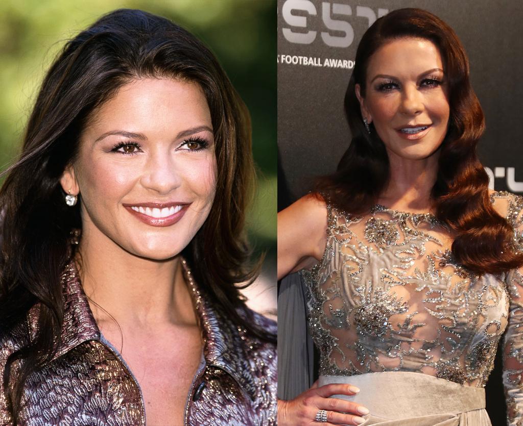 Halloween In Hollywood! Scariest Celeb Plastic Surgery Nightmares of 2017