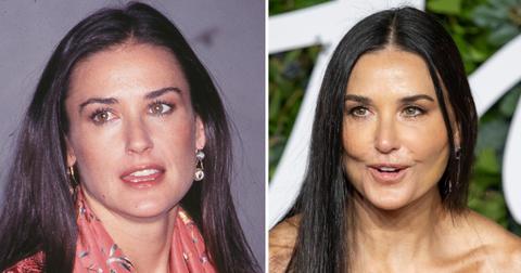 Demi Moore's Shocking New Face, Plastic Surgeons Weigh In