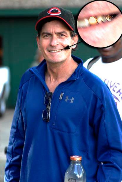 PHOTOS: Charlie Sheen Flashes Golden Smile; Tells UCLA Baseball Team ...
