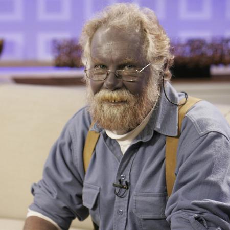 'Blue Man' Paul Karason Dies At 62