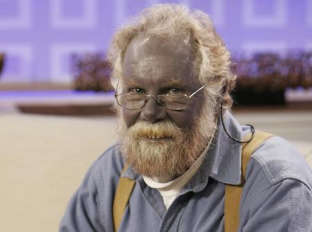 'Blue Man' Paul Karason Dies At 62