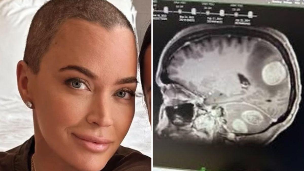 John Mellencamp's Devastating Update On Daughter Teddi's Cancer Battle