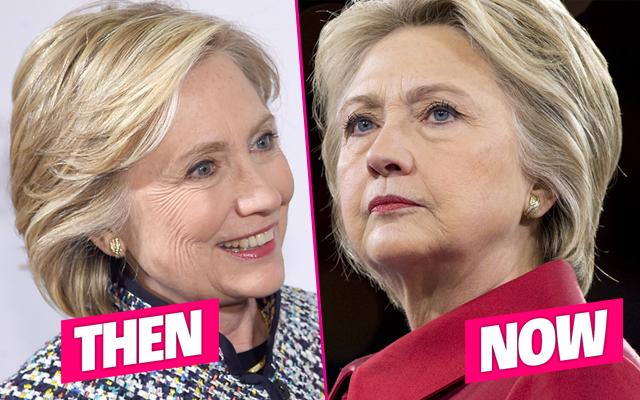 Botox, Peels & More! Hillary Clinton Is A Plastic Prez Wannabe, Top ...