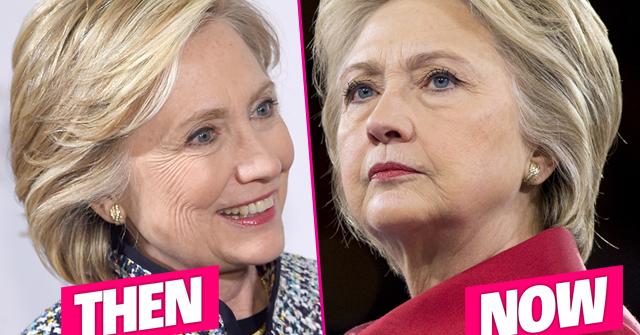 Botox, Peels & More! Hillary Clinton Is A Plastic Prez Wannabe, Top ...