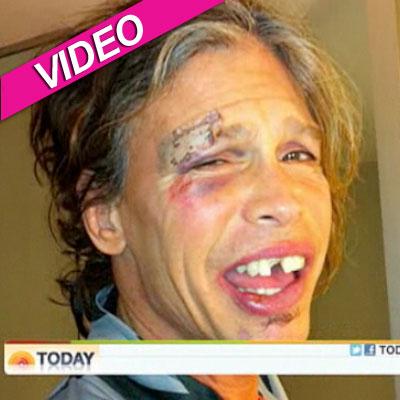 Steven Tyler On Bathroom Slip: ‘It Was An Accident, Not A Relapse’