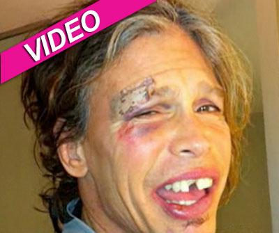 Steven Tyler On Bathroom Slip: ‘It Was An Accident, Not A Relapse’