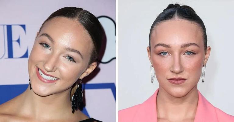 Celebrities Who Admitted To Getting A Nose Job: Ashley Tisdale & More
