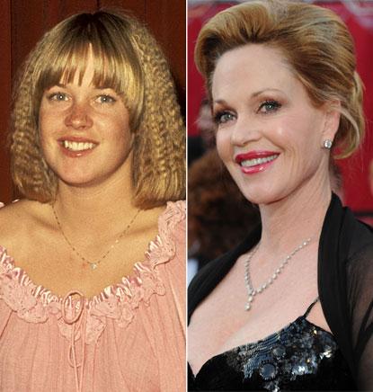 Scariest Plastic Surgery Faces