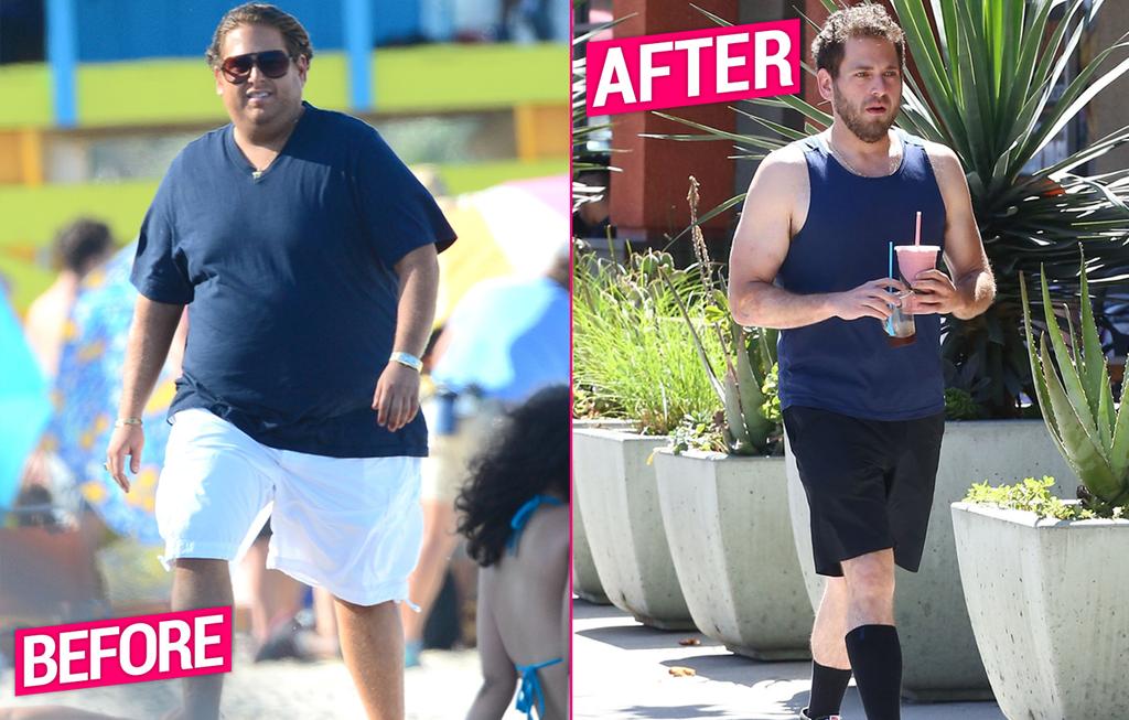 Weight Loss Cheater? Jonah Hill Had Lap Band Surgery, Says Pal.