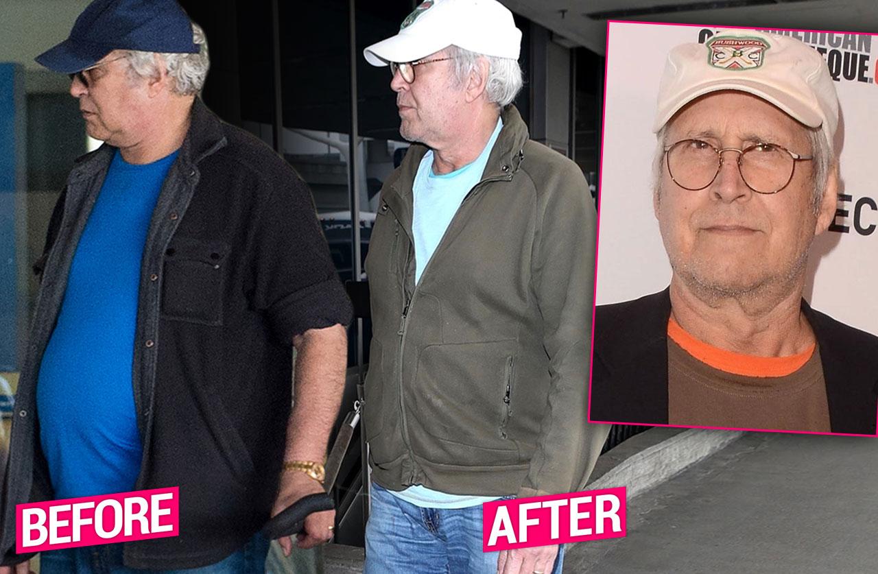 Chevy Chase – Comic Legend Loses 100 Pounds Through Surgery And Rehab ...
