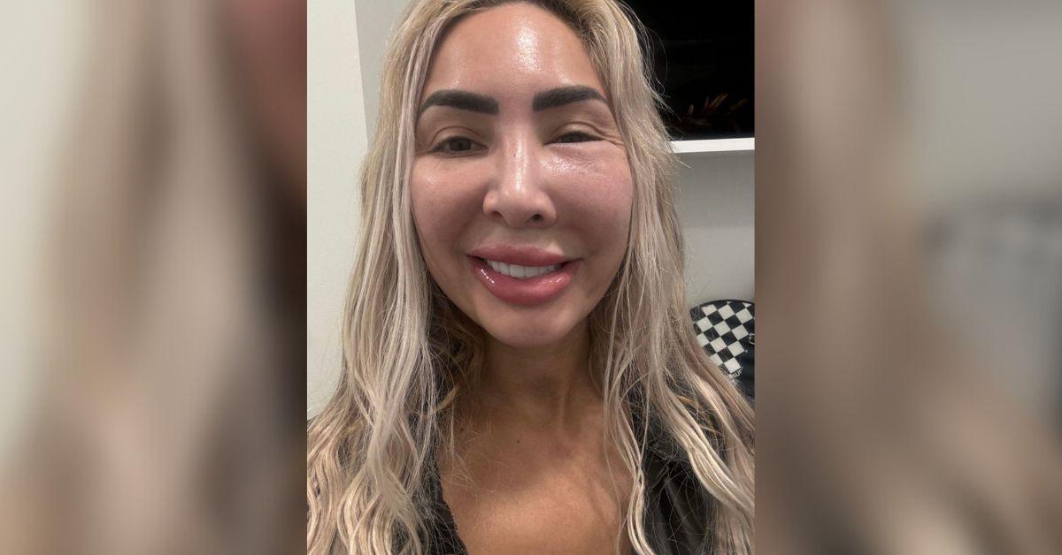 Teen Mom Farrah Abraham Reveals Swollen Face after Botched Plastic ...