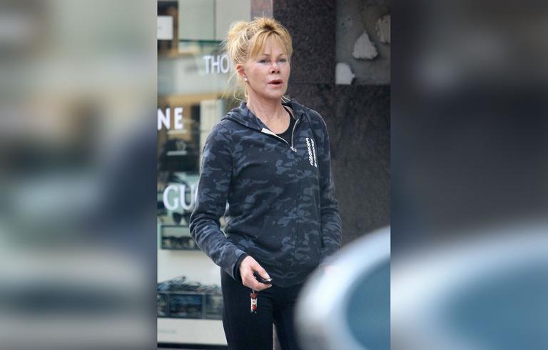 Melanie Griffith Wears Nose Bandage After Skin Cancer Treatment