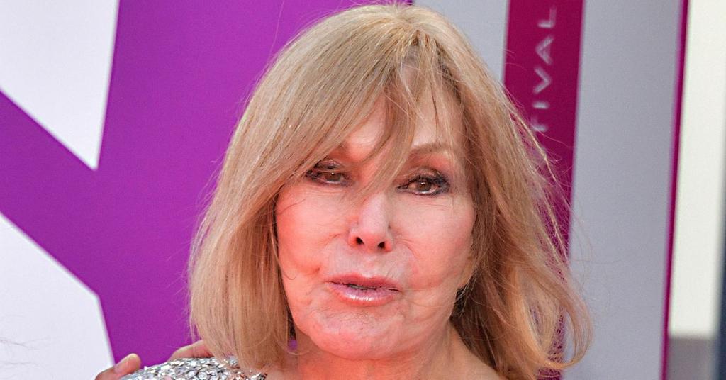 Kim Novak's Plastic Surgery Disaster: Doc Says 'Hollywood Ruins Beauty'