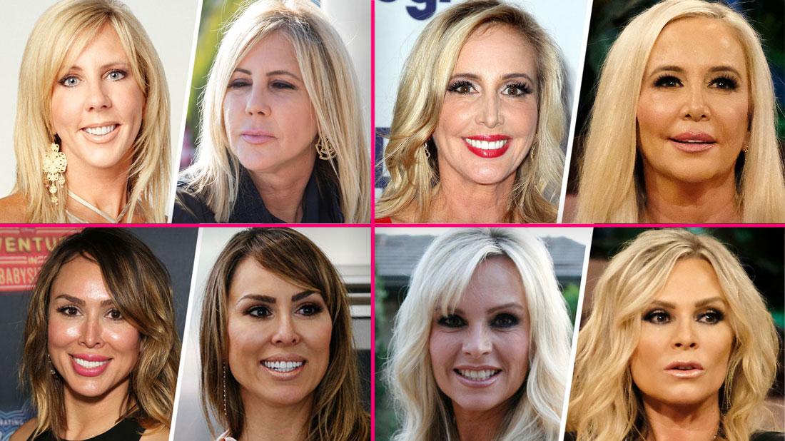 'RHOC' Cast Plastic Surgery Transformations Exposed Top Docs