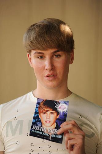 Justin Bieber Fanatic Toby Sheldon Has Plastic Surgery To Look Like The ...