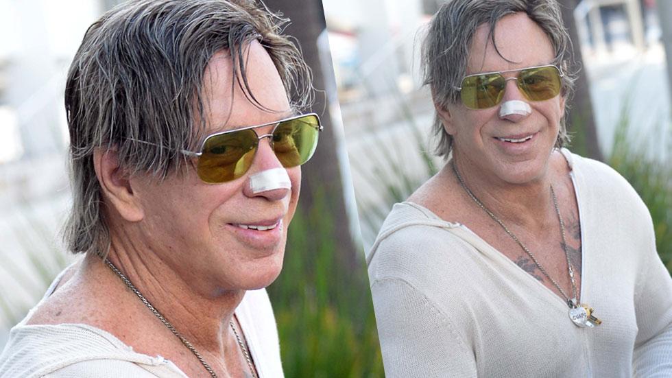More Time Under The Knife For Mickey? Rourke Sports Bandaged Nose In 8 ...