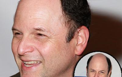 Jason Alexander : ‘Yes, I’m Still Bald’