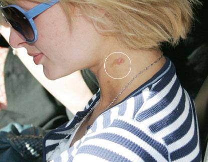 Celebrities With Hickeys!