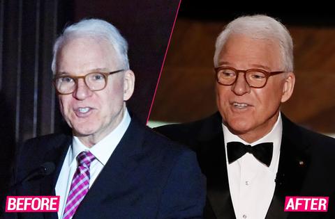 Plastic Surgeons Reveal Steve Martin's Secrets To Youthful Look