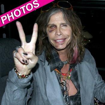 Steven Tyler Shows Off His Bruised Face