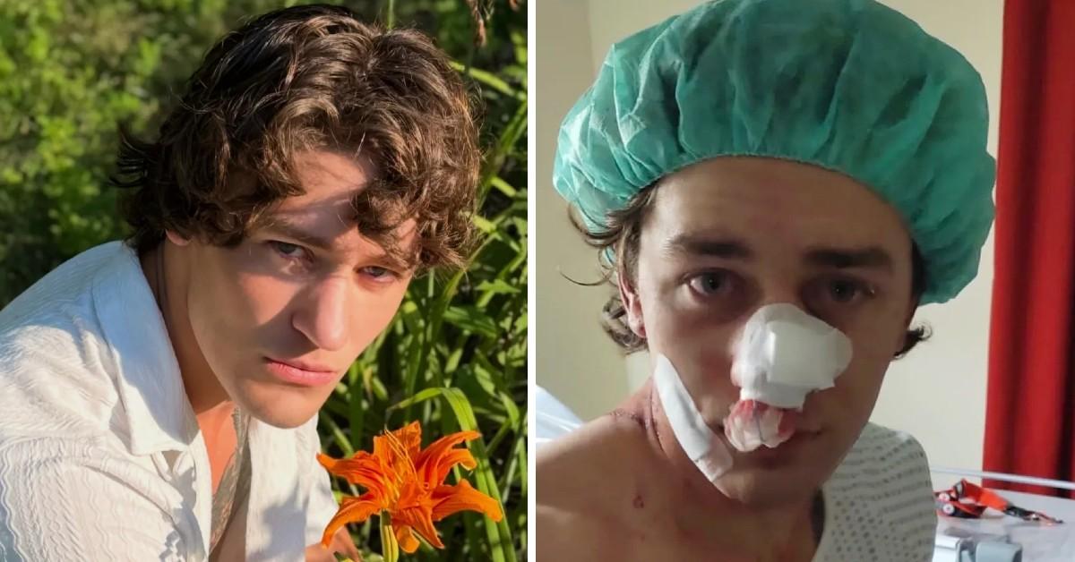 PHOTOS: Model Beaten While Defending Women From 'Illegal Migrant'