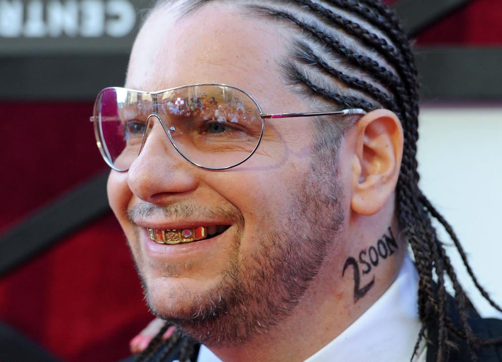 Grillz Gone Wild -- Can You Match The Bling To The Star?