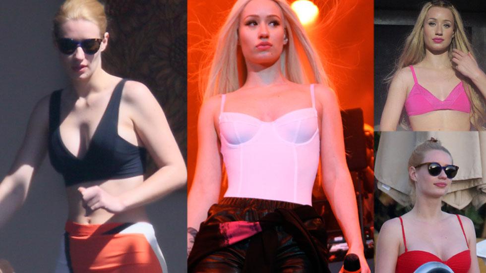 One Less Problem Top Doc Claims Iggy Azalea Got A Boob Job See The