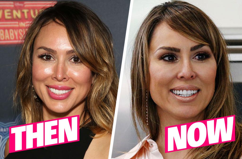 'RHOC' Cast Plastic Surgery Transformations Exposed Top Docs