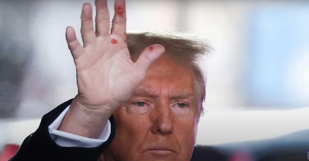 James Carville Goes on Unhinged Rant, Claims Donald Trump has Syphilis