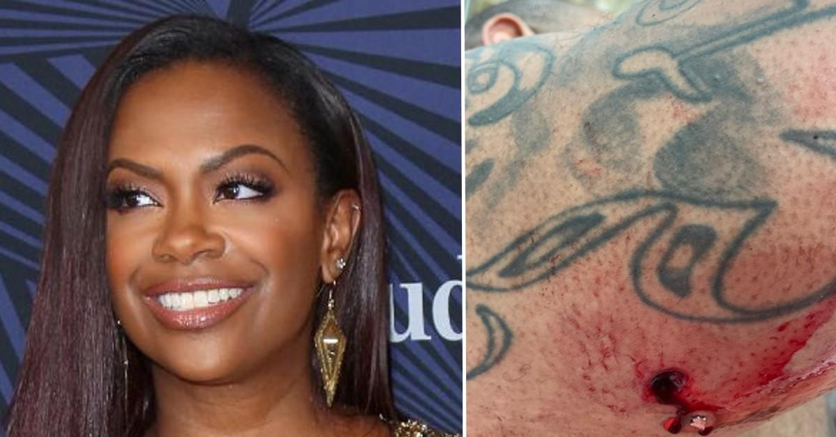 Kandi Burruss’ Cousin Shows Off Gunshot Wounds After Co-Worker Shots Him At ‘RHOA’ Star’s Restaurant