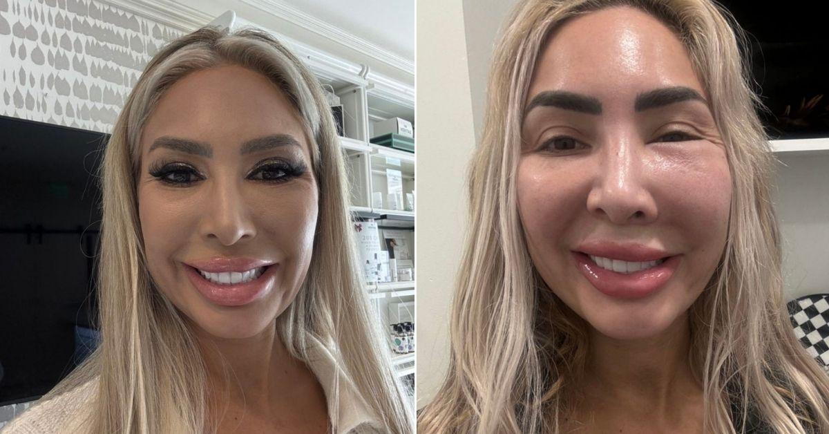 Teen Mom Farrah Abraham Reveals Swollen Face after Botched Plastic ...