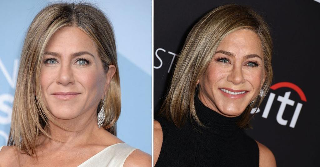 Jennifer Aniston's 'Tired' Face Is Due To Botched Filler, Surgeon Claims