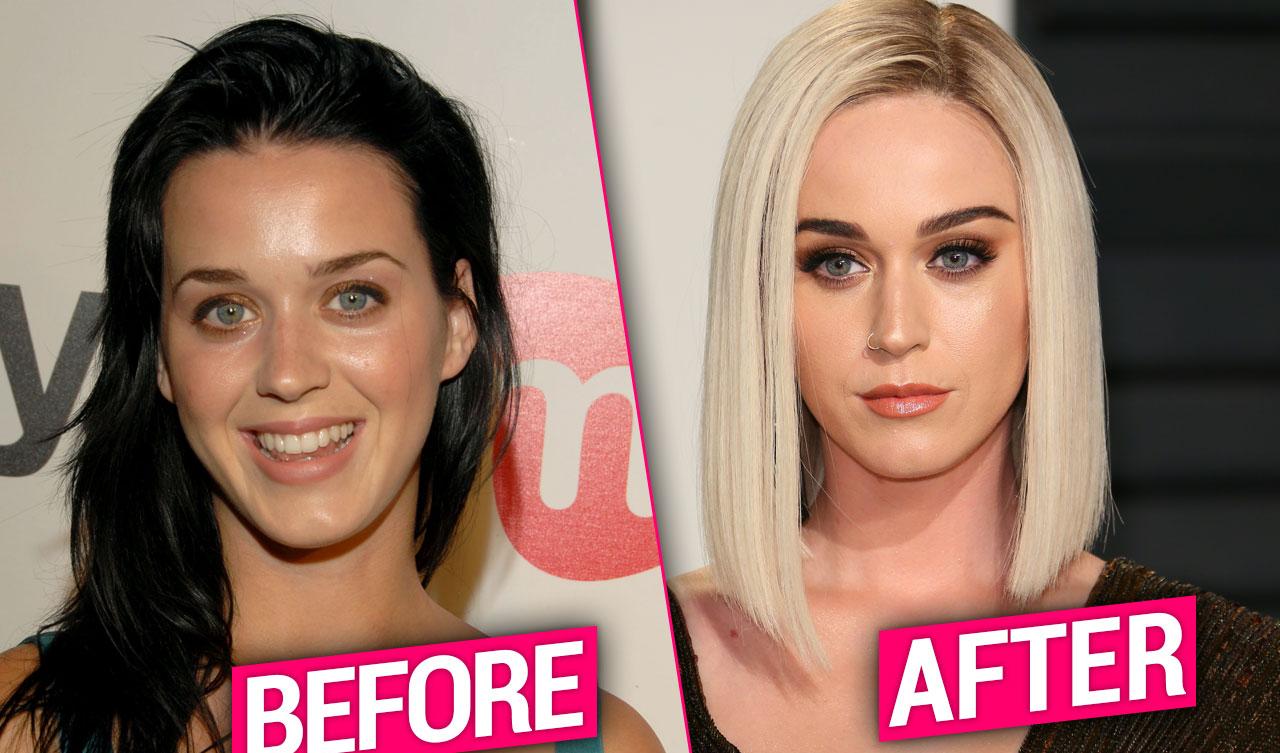 Katy Perry’s Plastic Surgery Lies? Star's Had Work Done, Top Docs Say
