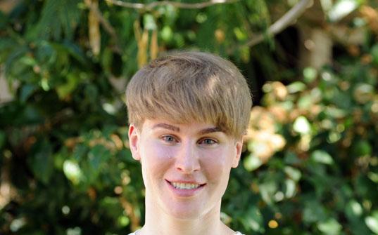 Justin Bieber Fanatic Toby Sheldon Has Plastic Surgery To Look Like The ...