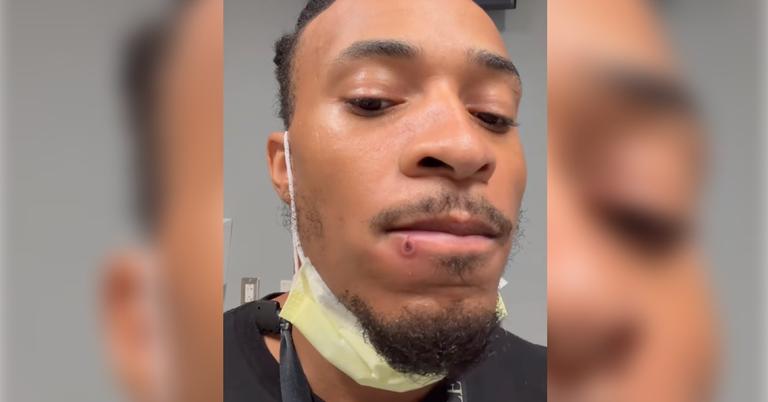 Man Diagnosed With Monkeypox Shares Startling Symptoms