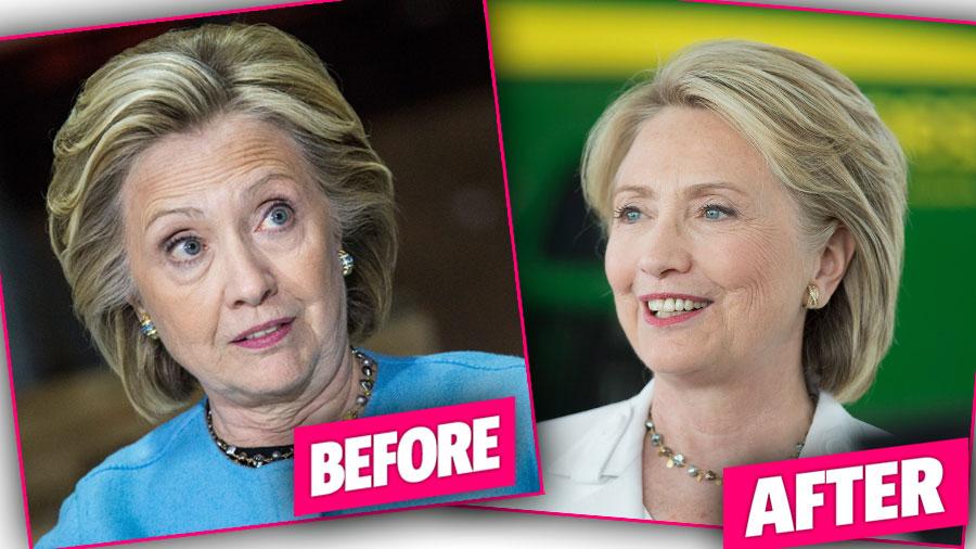 So Cruel! Bill Clinton Pressured Aging Hillary Into Secret Facelift ...