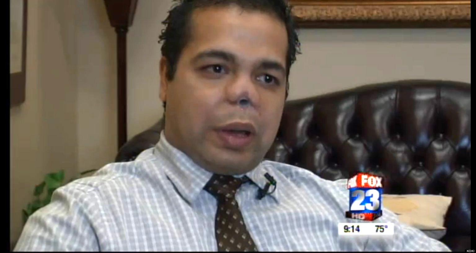 15 Extreme Real Life Plastic Surgery Disasters