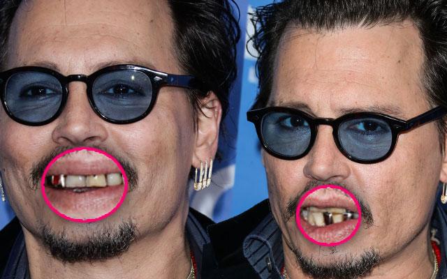 Former Sex Symbol Johnny Depp Spotted With Yellow Teeth