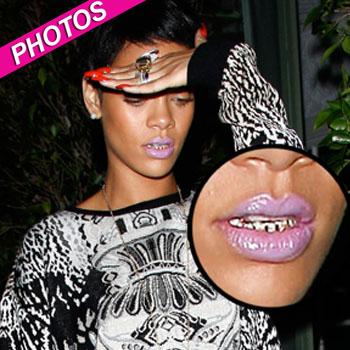 Dental Disturbia! Rihanna Shows Off Her New Gold ‘Grillz’