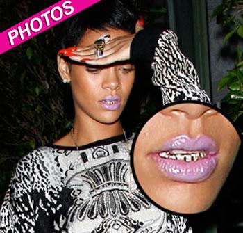 Dental Disturbia! Rihanna Shows Off Her New Gold ‘Grillz’