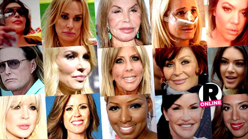 When Plastic Is Fantastic! 30 Reality Stars’ Nips & Tucks REVEALED