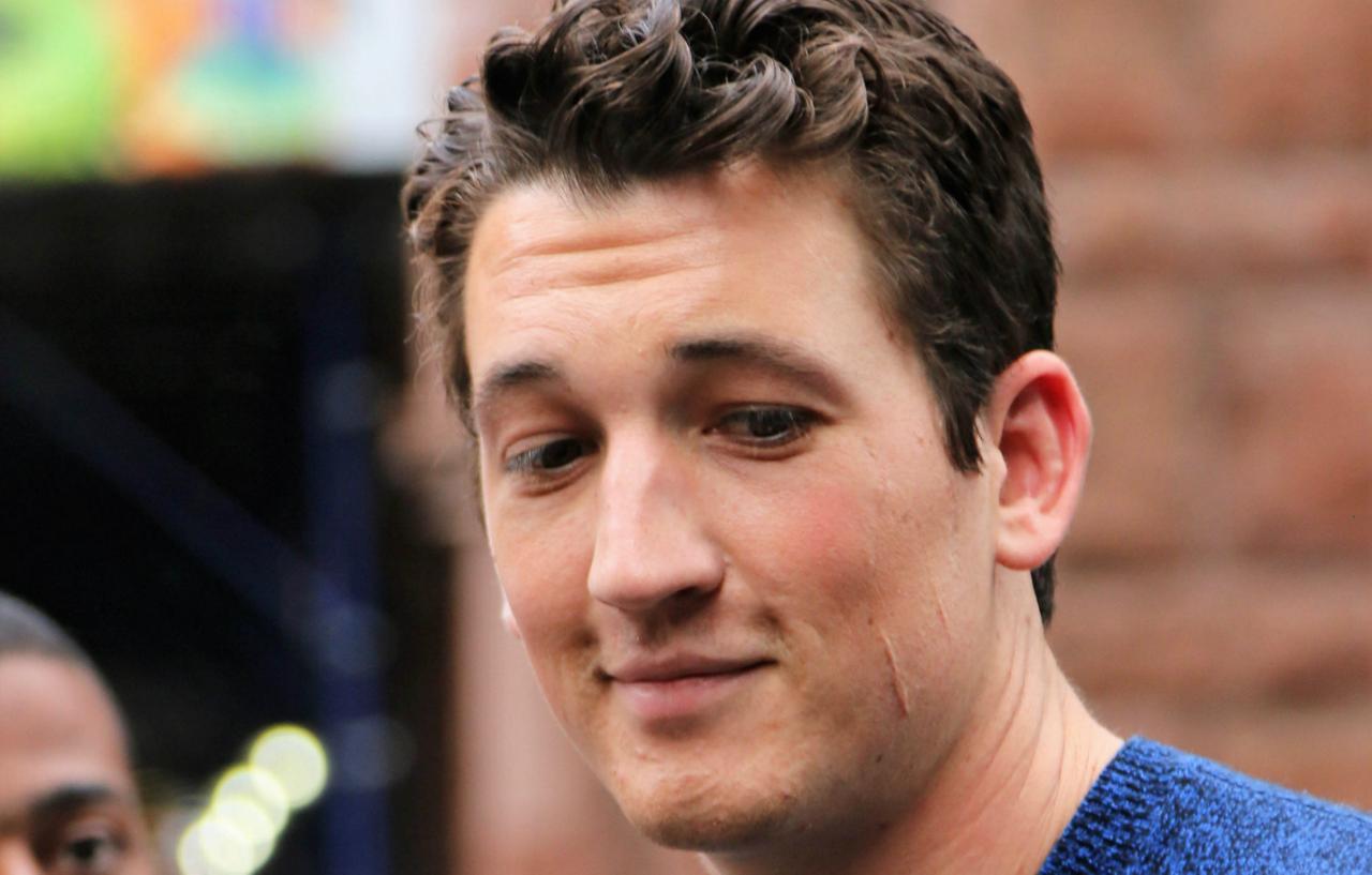 Famous Flaws! The Top 35 Celebrity Deformities