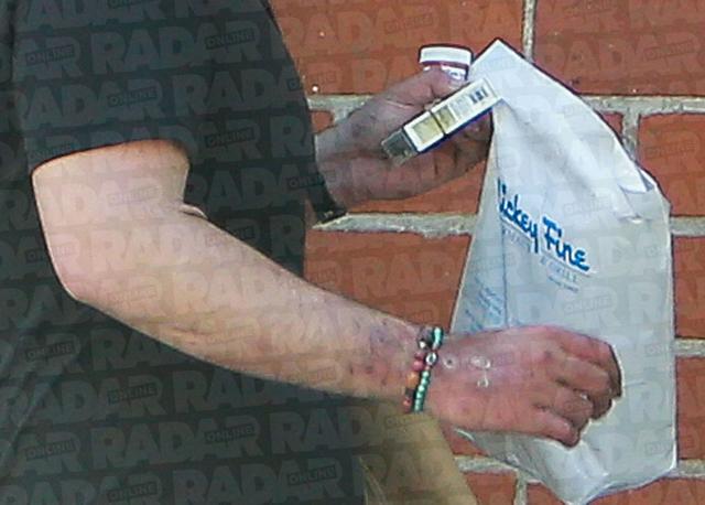 Billionaire To Rock Bottom: Jason Davis Covered In Track Marks At Seedy ...