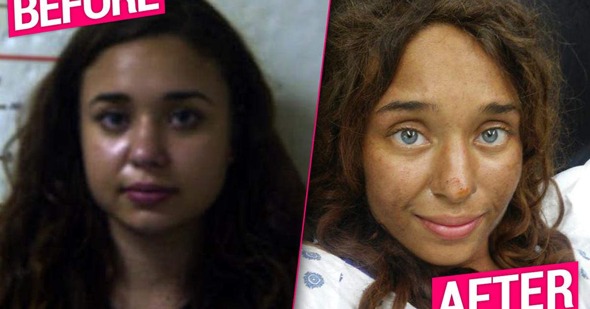 Alabama Woman Lost In Woods Was NOT High On Meth, Mom Says