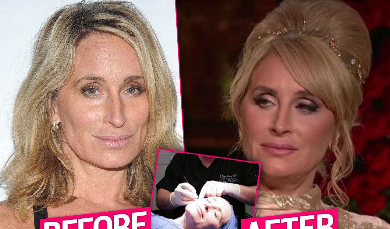 Sonja Morgan Plastic Surgery Makeover For ‘RHONY’ Reunion