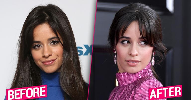 Camila Cabello's Alleged Plastic Surgery Transformation Exposed