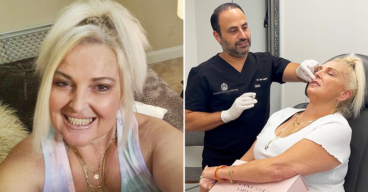 '90 Day Fiancé' Star Angela Deem Gets Lip Fillers And Botox-Like ...